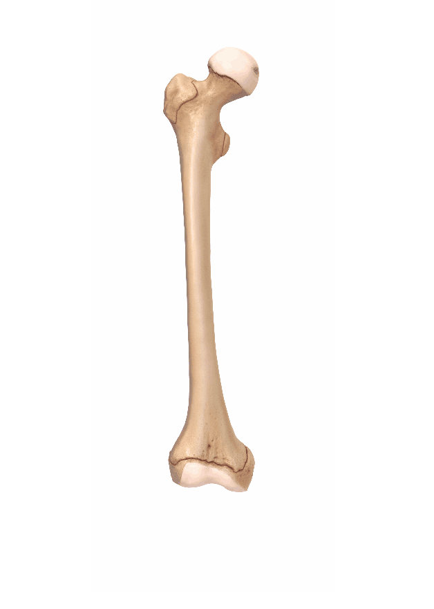 Developmental Leg Length Discrepancy Damaging Growth Plates