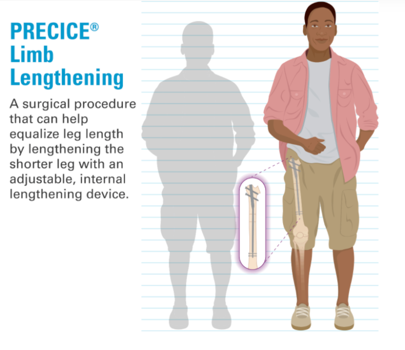 Screen Shot 2020-12-11 at 10.03.03 AM - Reach Your Height: PRECICE Limb ...